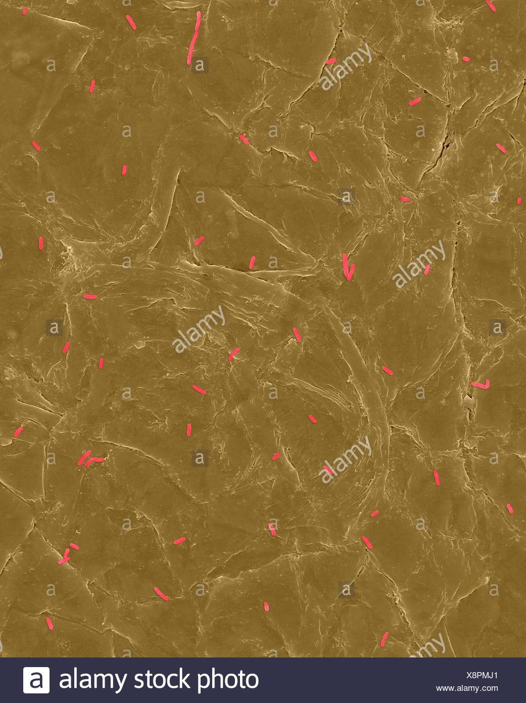 Escherichia Coli Bacteria Sem High Resolution Stock Photography and ...