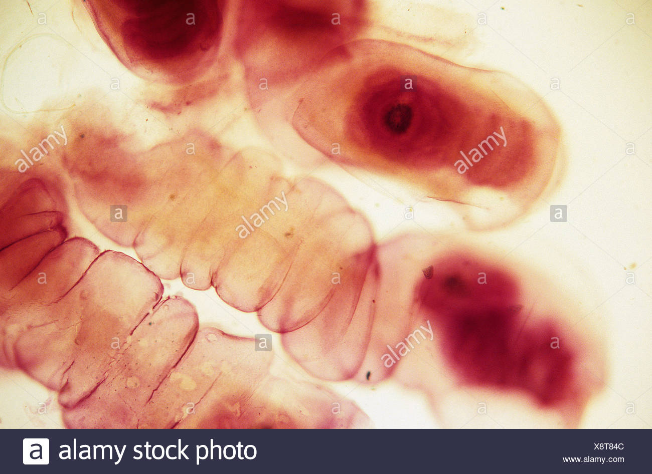 Cestode High Resolution Stock Photography and Images - Alamy