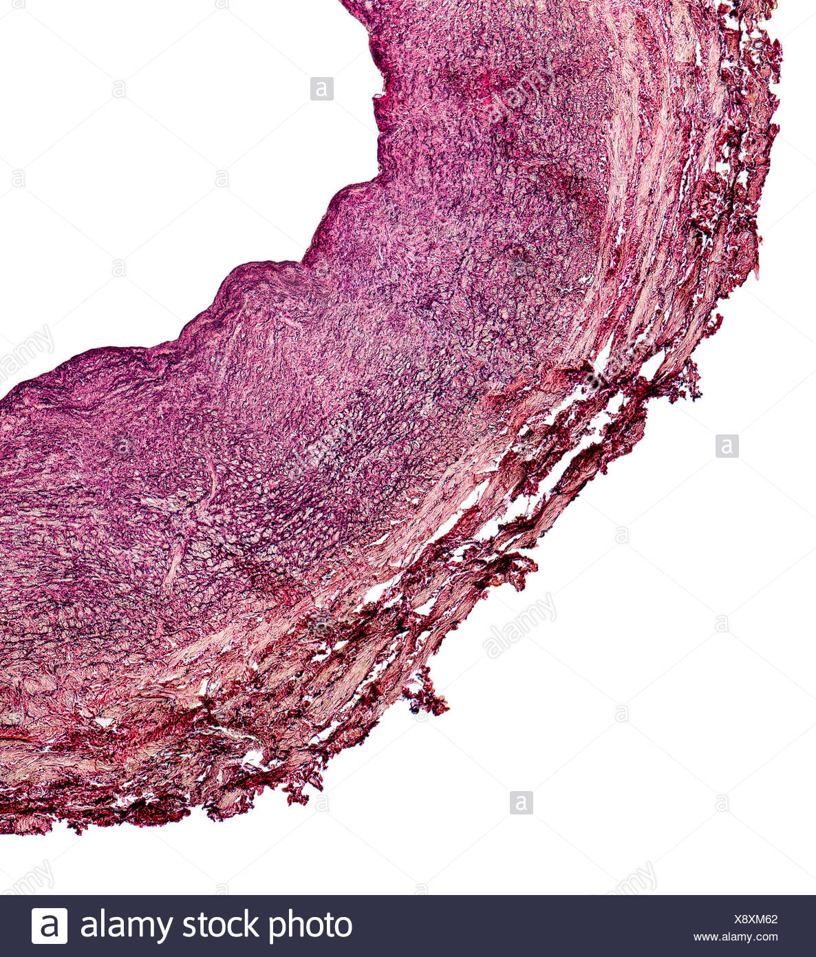Cross Section Of A Blood Vessel High Resolution Stock Photography and ...