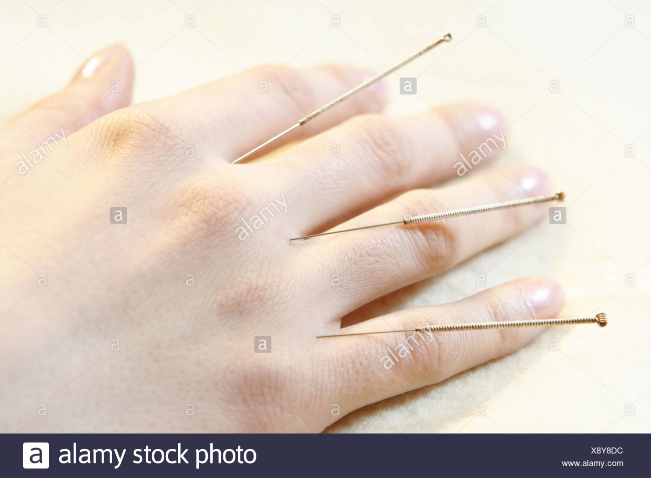 Acupuncture Dots Stock Photos & Acupuncture Dots Stock Images - Alamy