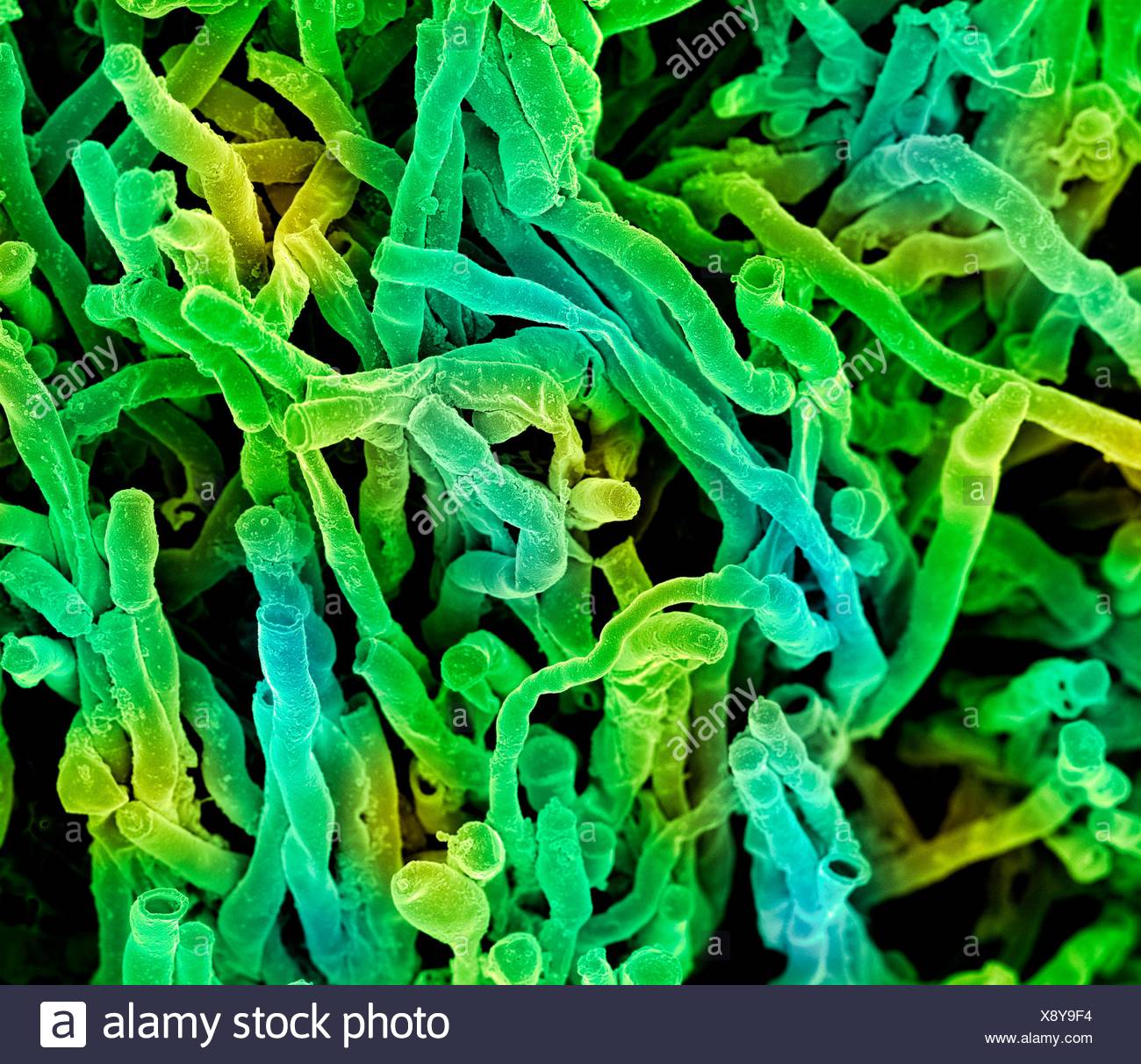 Actinomyces Viscosus Bacteria High Resolution Stock Photography and ...