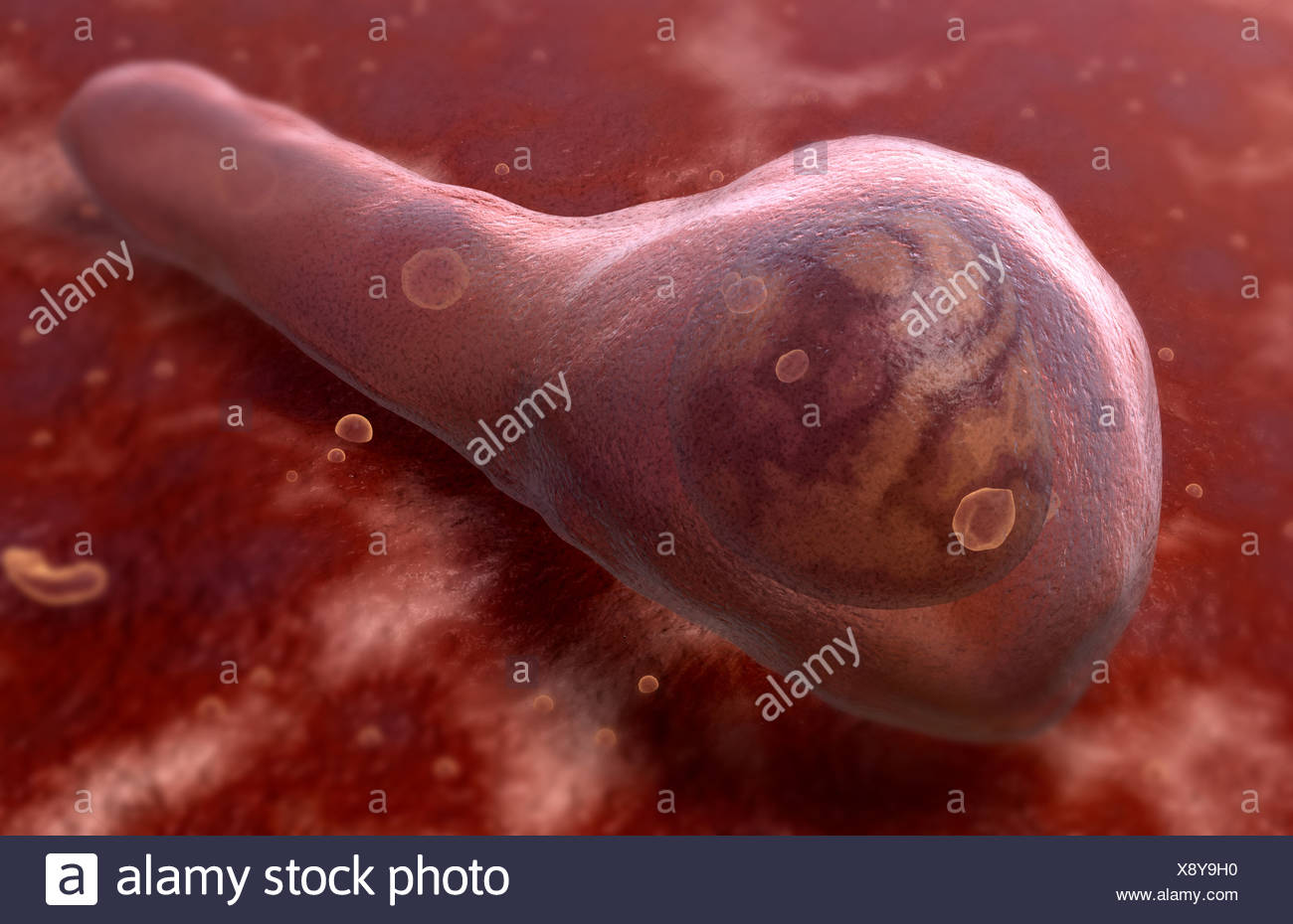 Clostridium Tetani High Resolution Stock Photography and Images - Alamy