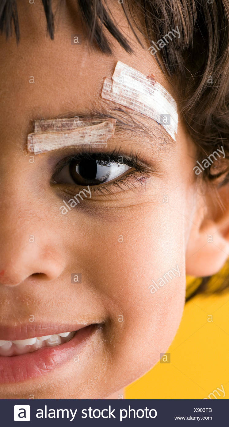 Black Eye Boy Injury Stock Photos & Black Eye Boy Injury Stock Images ...