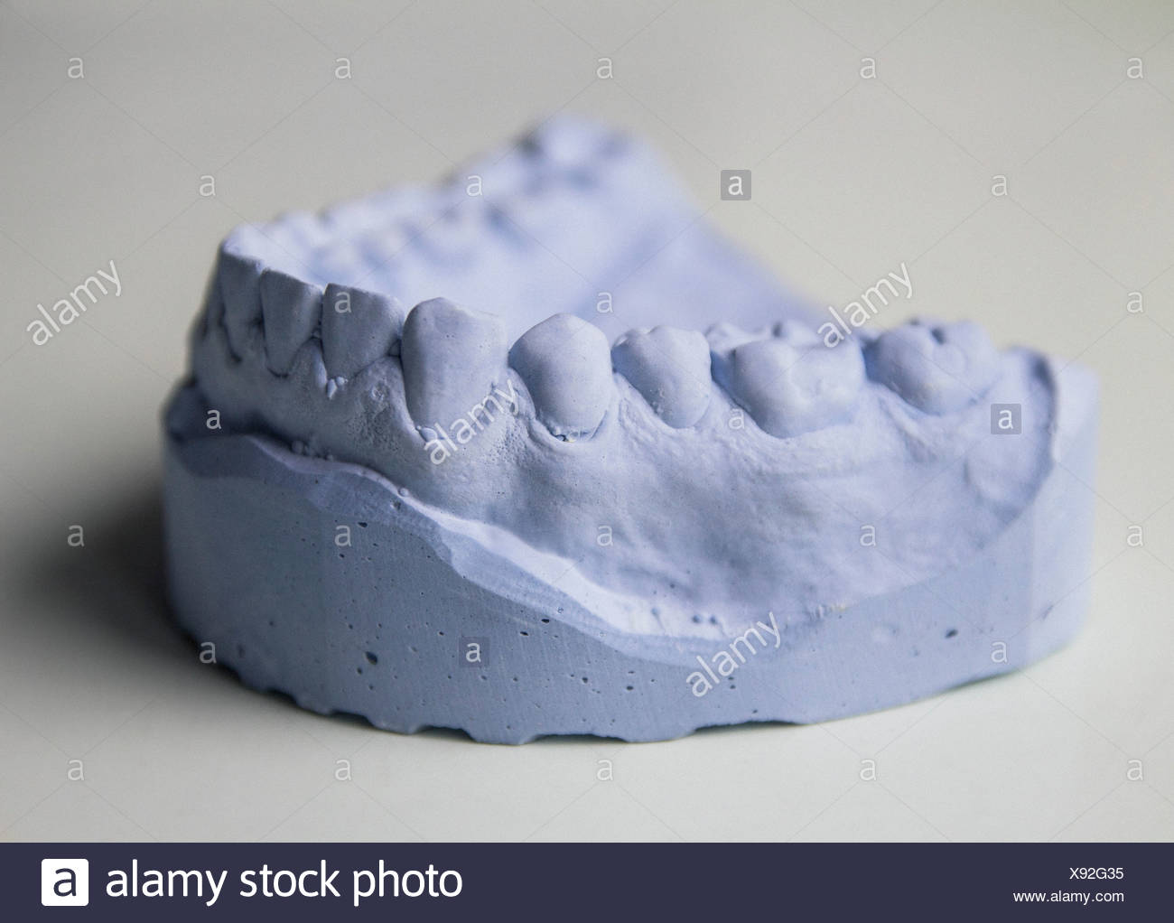 Dental Mould High Resolution Stock Photography and Images - Alamy