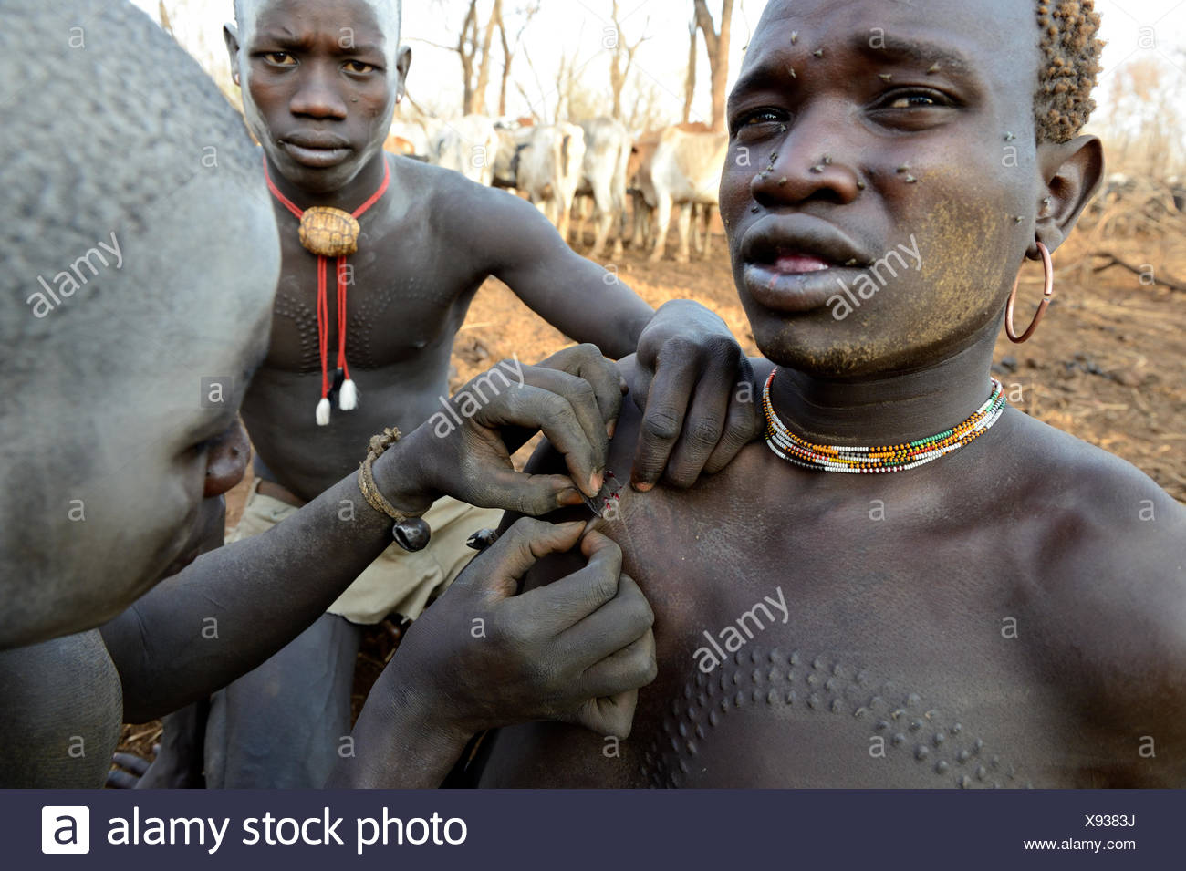 Skin Scarification Stock Photos & Skin Scarification Stock Images - Alamy