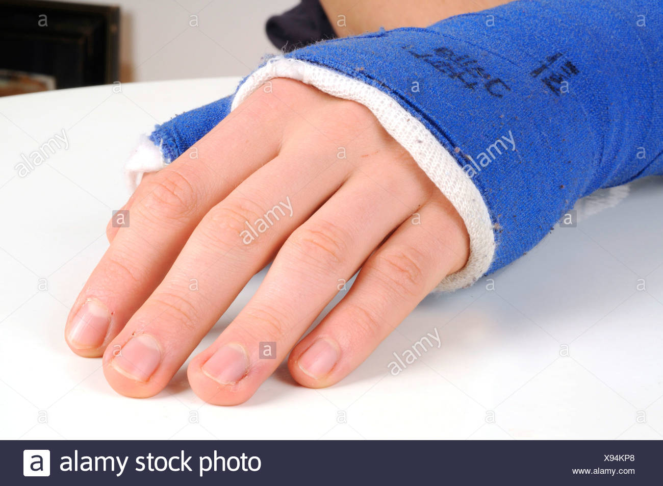 Wrist Plaster High Resolution Stock Photography and Images - Alamy