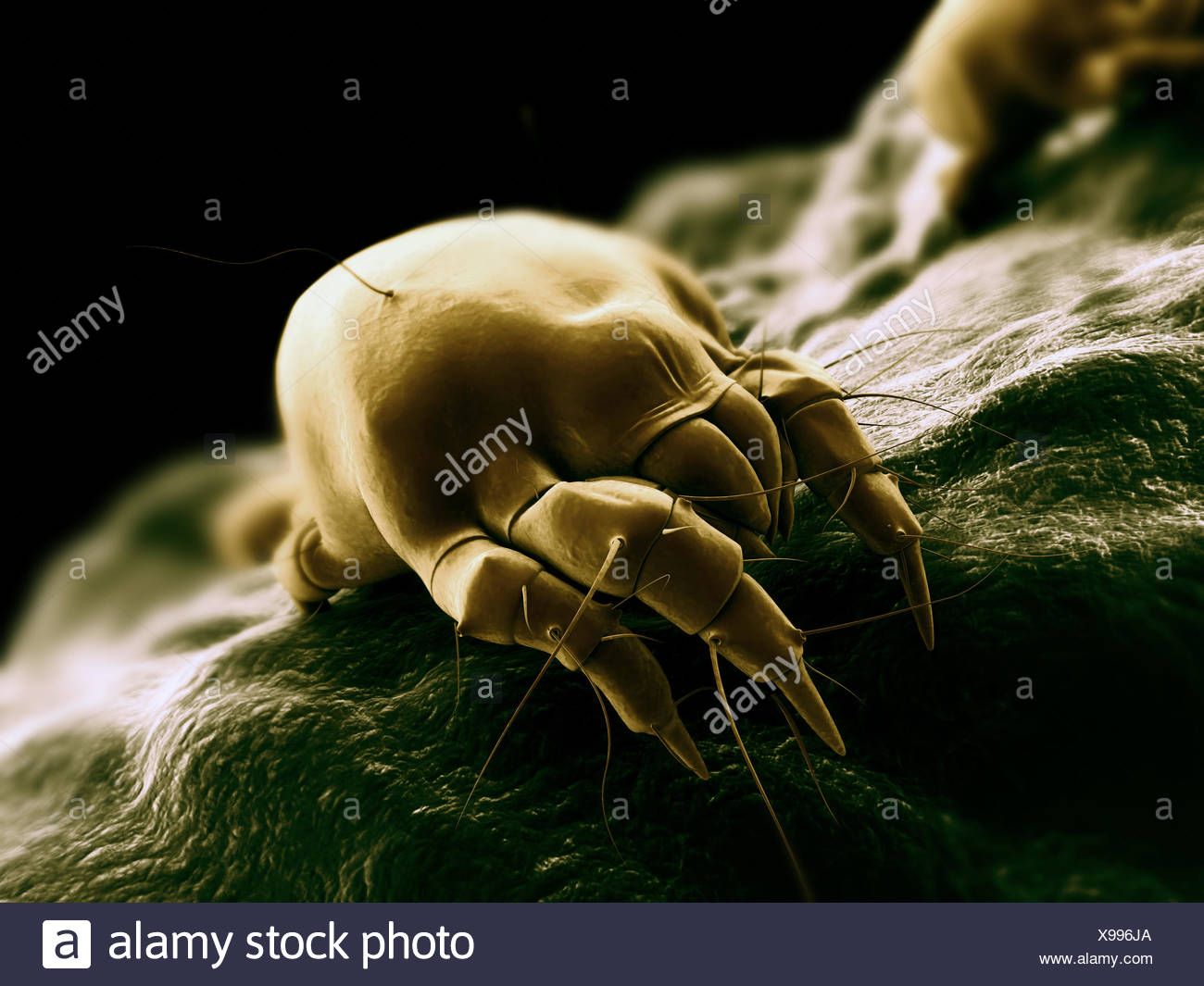 Insect Allergy High Resolution Stock Photography and Images - Alamy