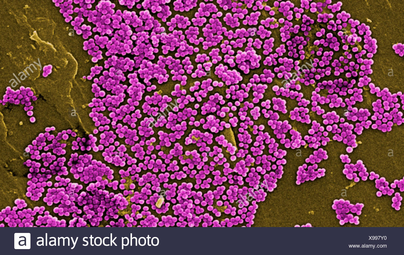 Scanning Electron Micrograph Aureus Bacteria High Resolution Stock ...