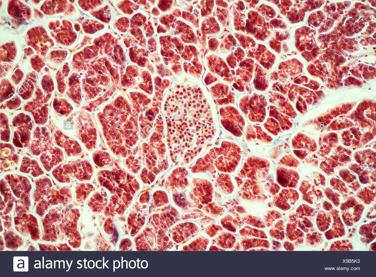 Pankreas High Resolution Stock Photography and Images - Alamy