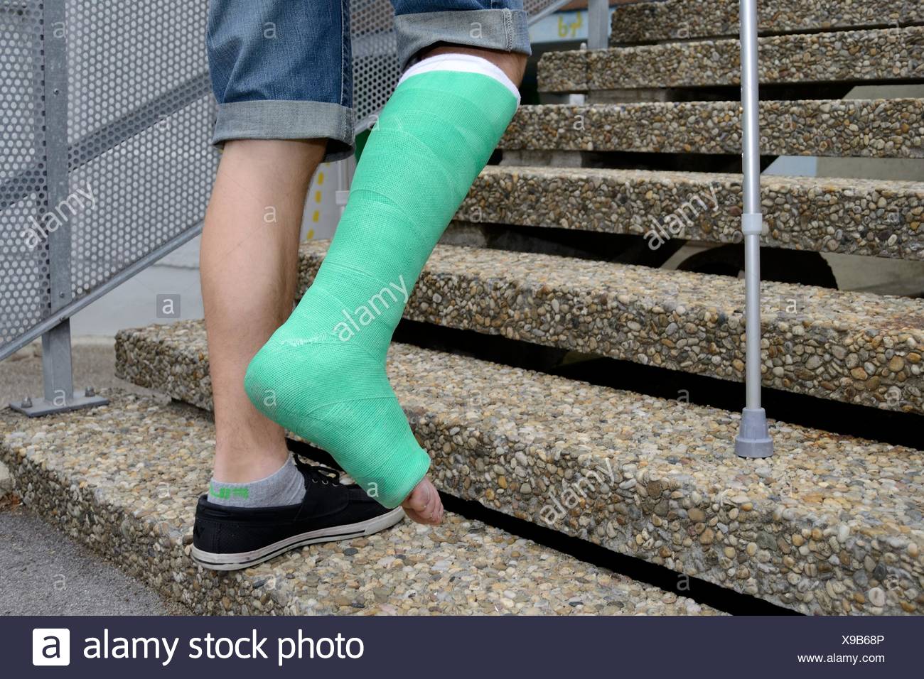 Plaster Cast Leg Stock Photos & Plaster Cast Leg Stock Images - Alamy