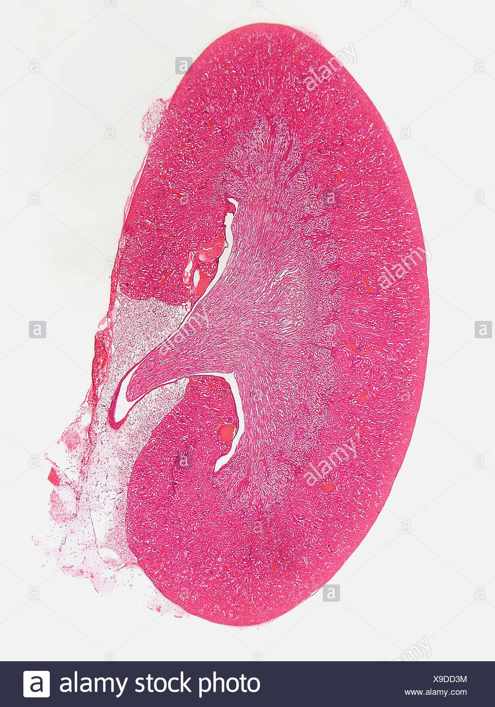 Kidney Cross Section High Resolution Stock Photography and Images - Alamy