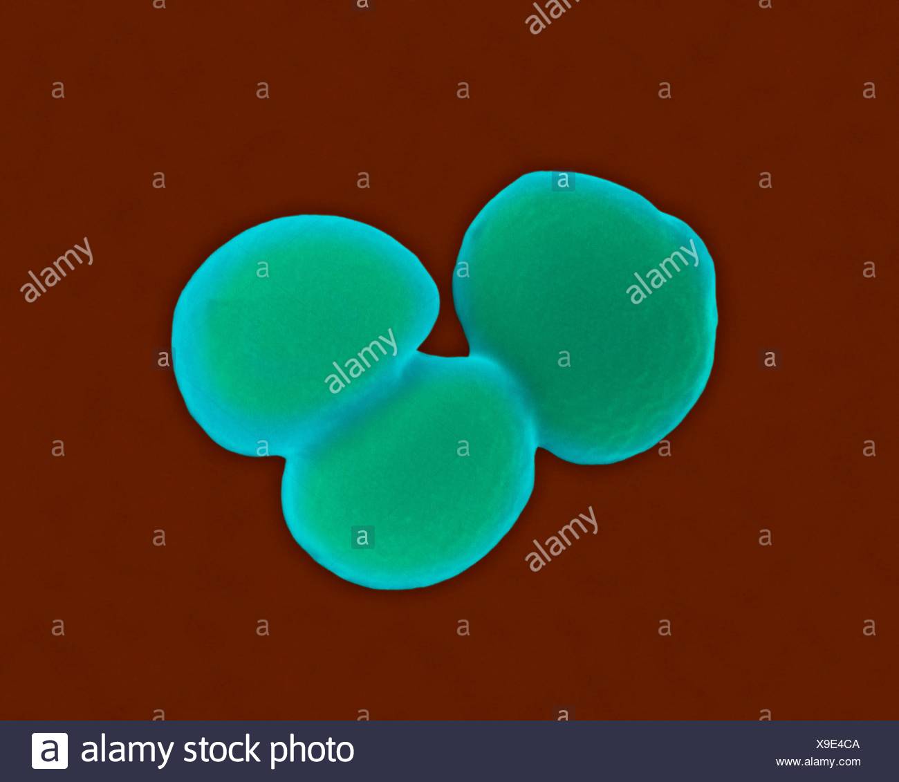 Staphylococcus Aureus Skin Stock Photos & Staphylococcus Aureus Skin ...