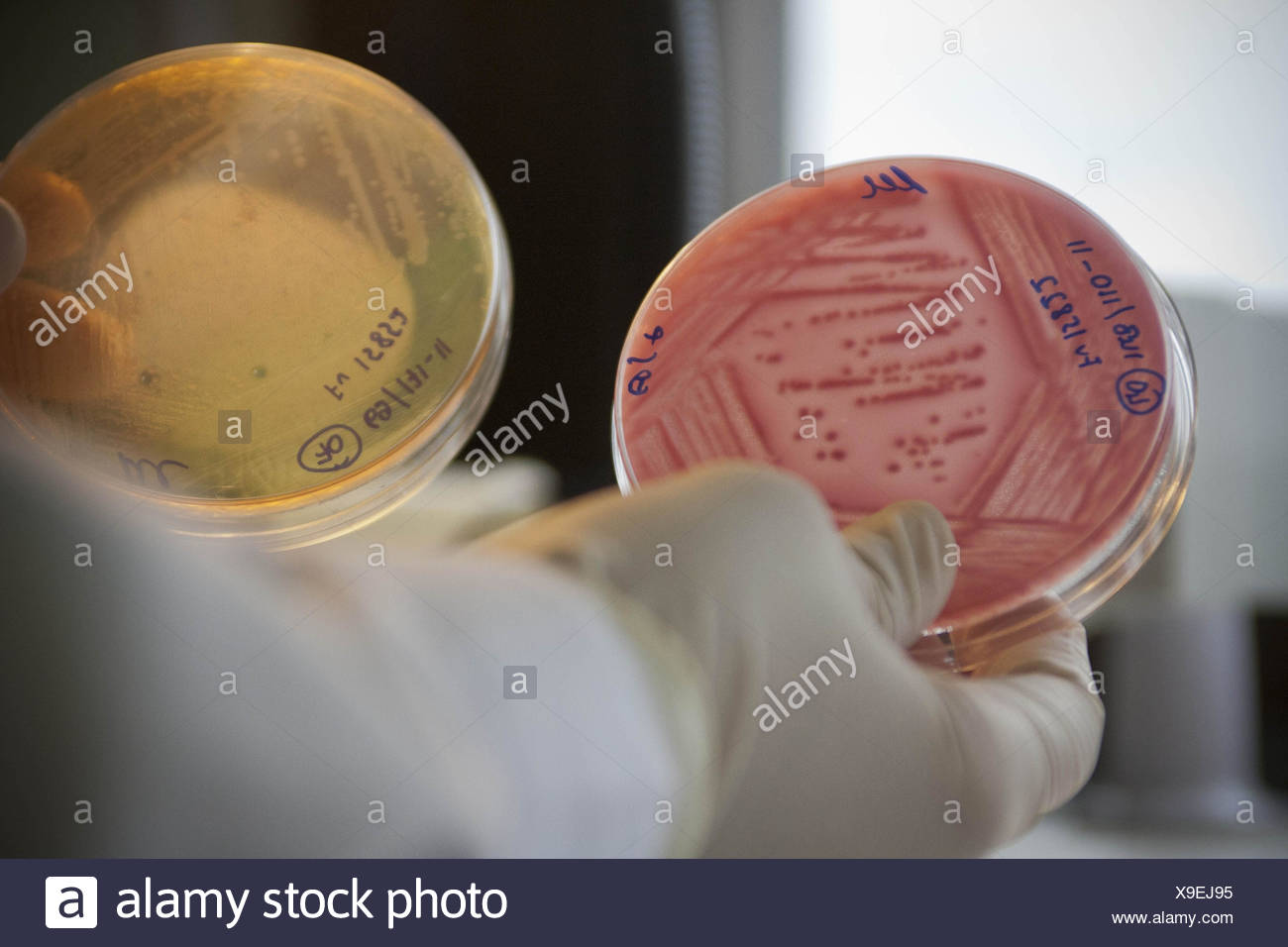 E Coli Stock Photos & E Coli Stock Images - Alamy