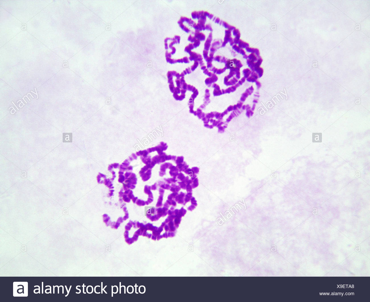 Chromosomes Microscope Stock Photos & Chromosomes Microscope Stock ...