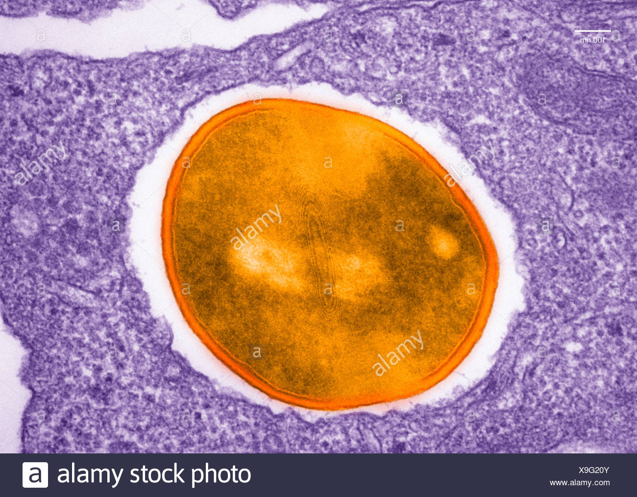 Staphylococcus Bacteria High Resolution Stock Photography and Images ...