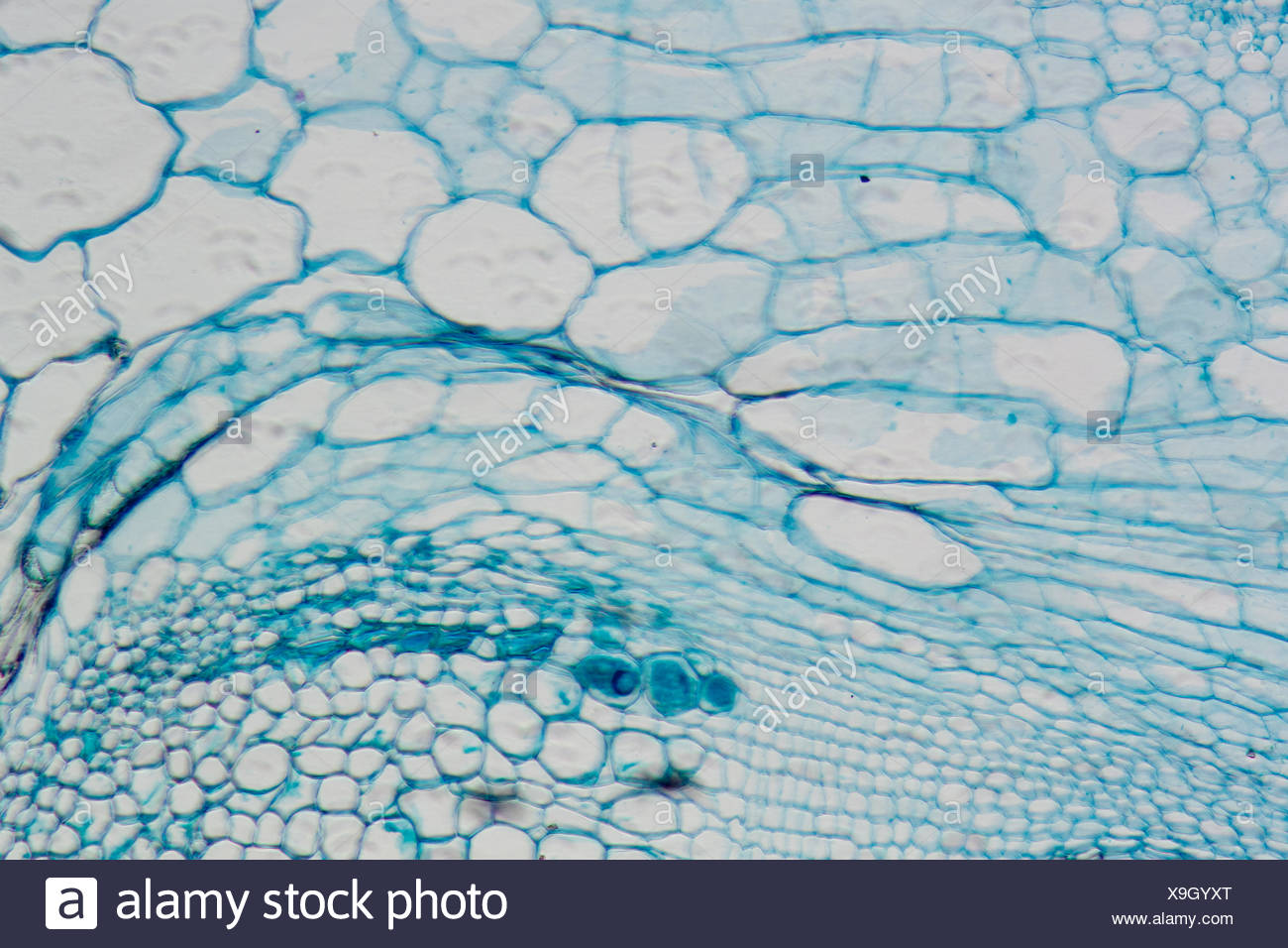 Xylem Micrograph High Resolution Stock Photography and Images - Alamy