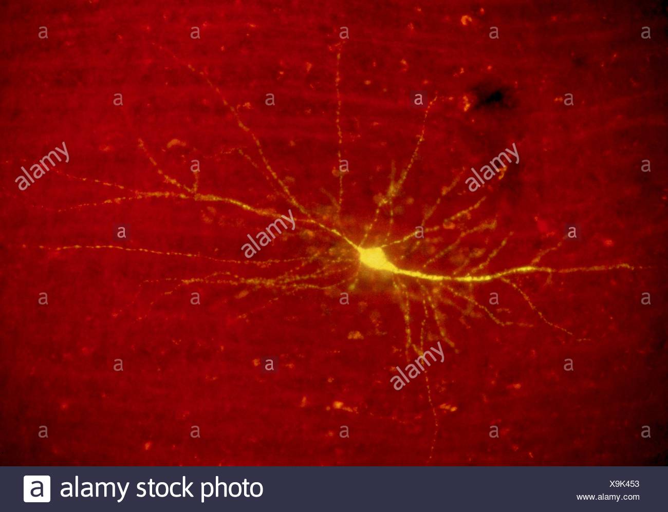 Cerebral Cortex Tissue High Resolution Stock Photography and Images - Alamy