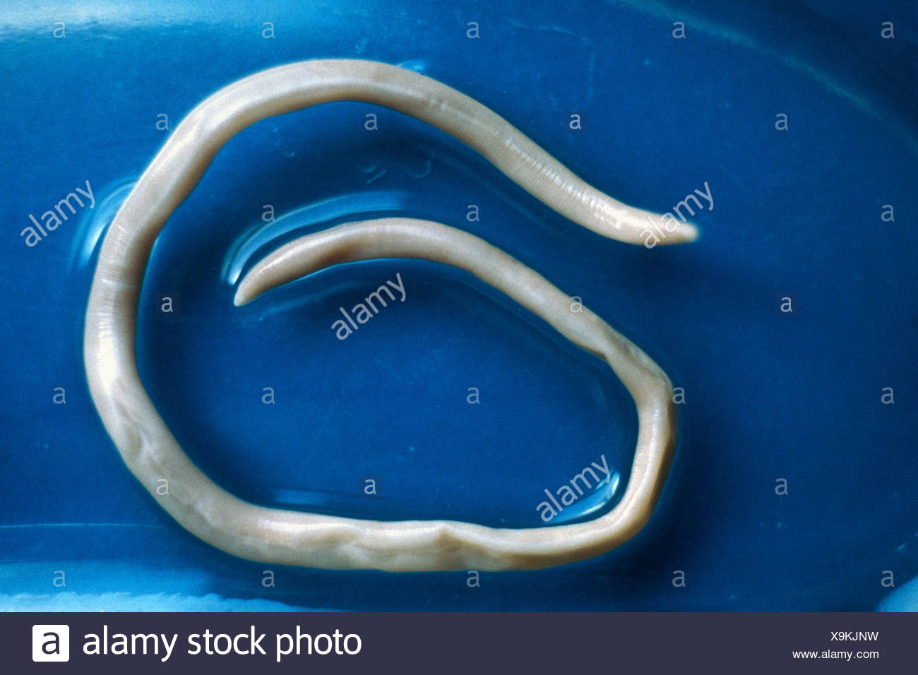 Ascariasis Stock Photos & Ascariasis Stock Images - Alamy