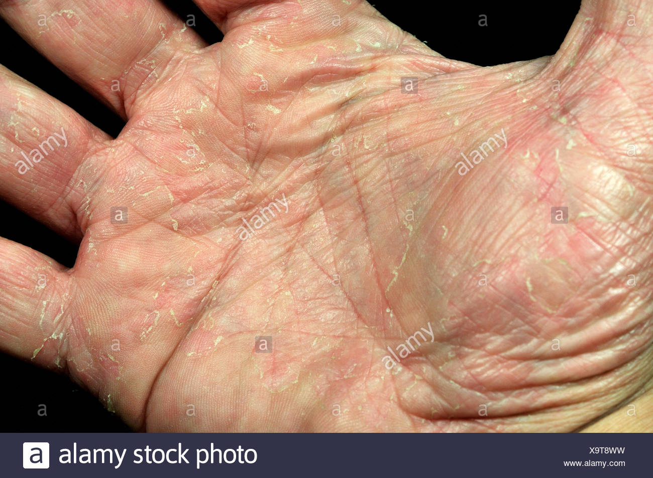 Psychosomatisch Stock Photos & Psychosomatisch Stock Images - Alamy