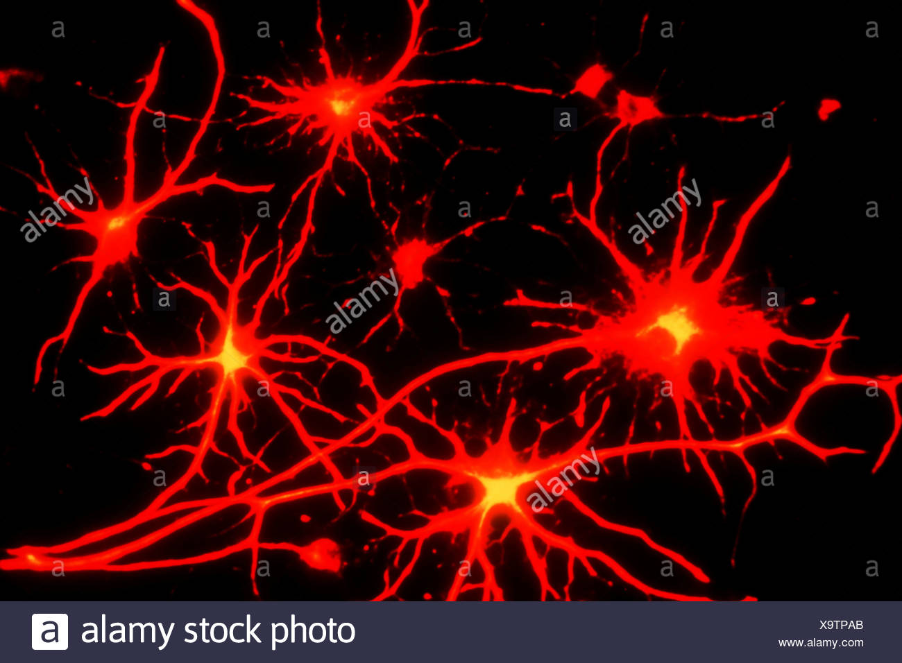Dendrites High Resolution Stock Photography and Images - Alamy