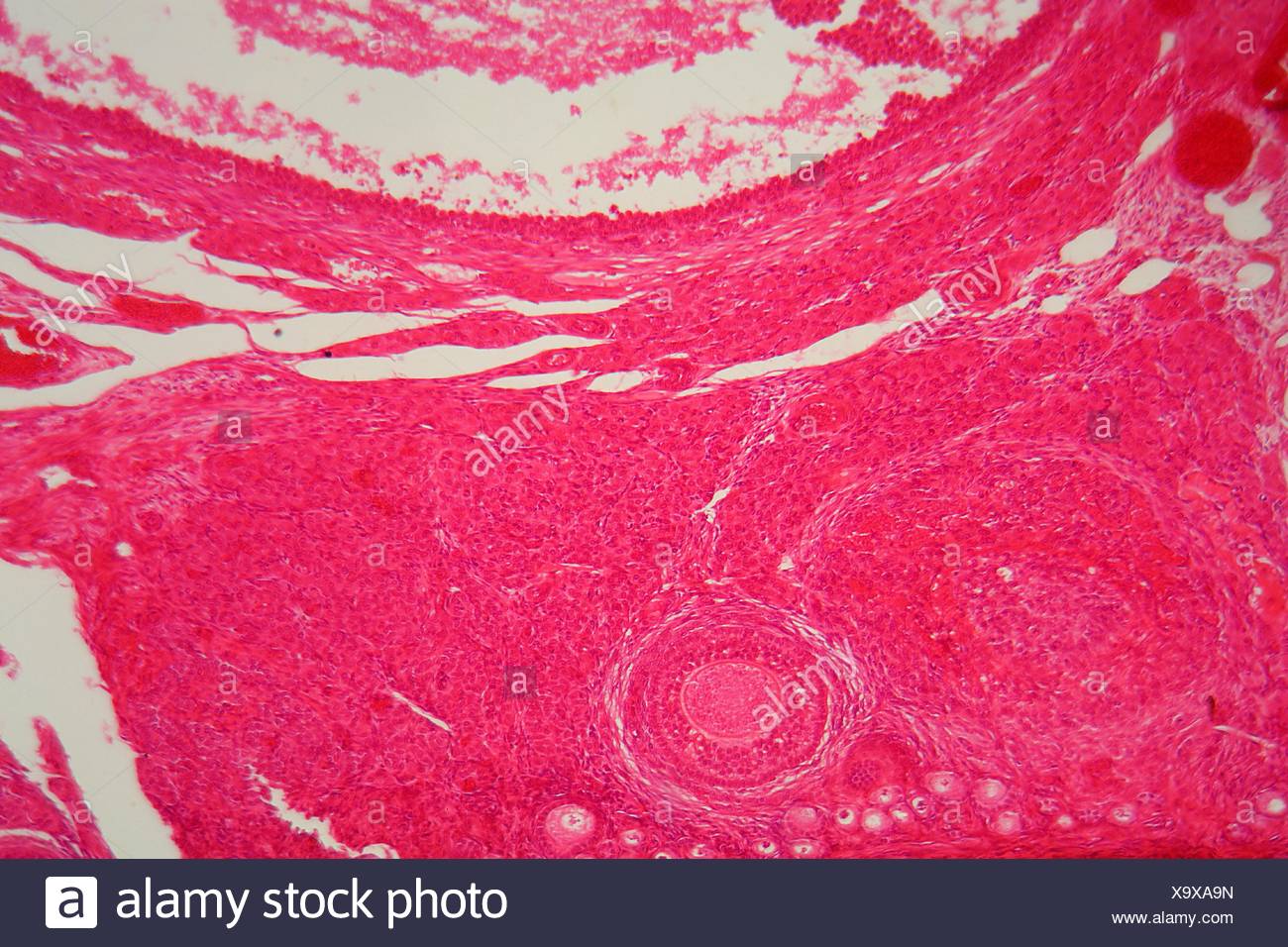 Ovary Micrograph High Resolution Stock Photography and Images - Alamy