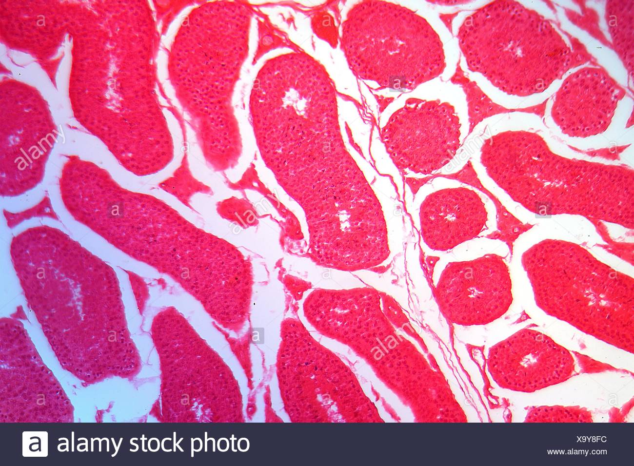 Cancer Of The Testicle Stock Photos & Cancer Of The Testicle Stock ...