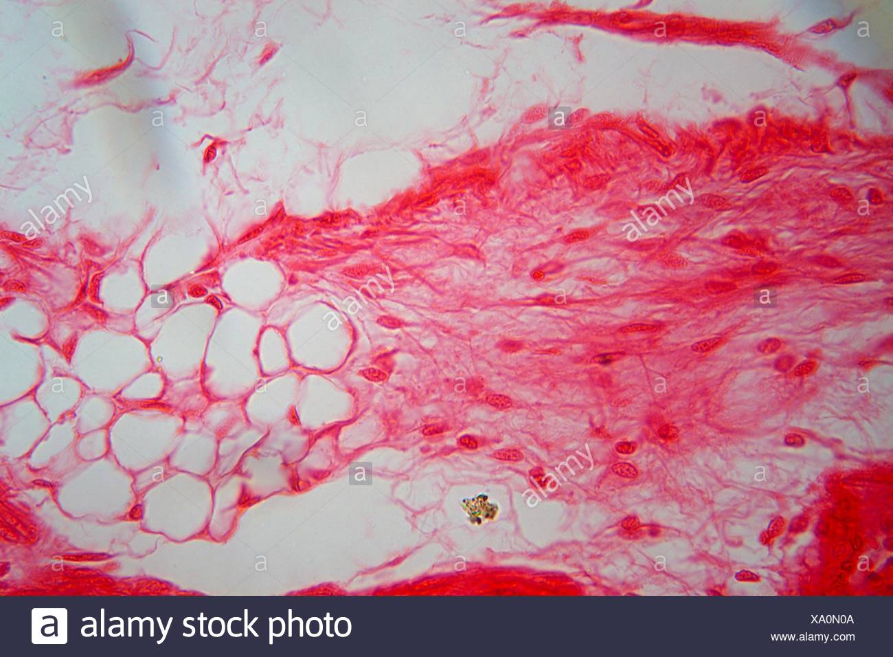 Trachea Micrograph High Resolution Stock Photography and Images - Alamy