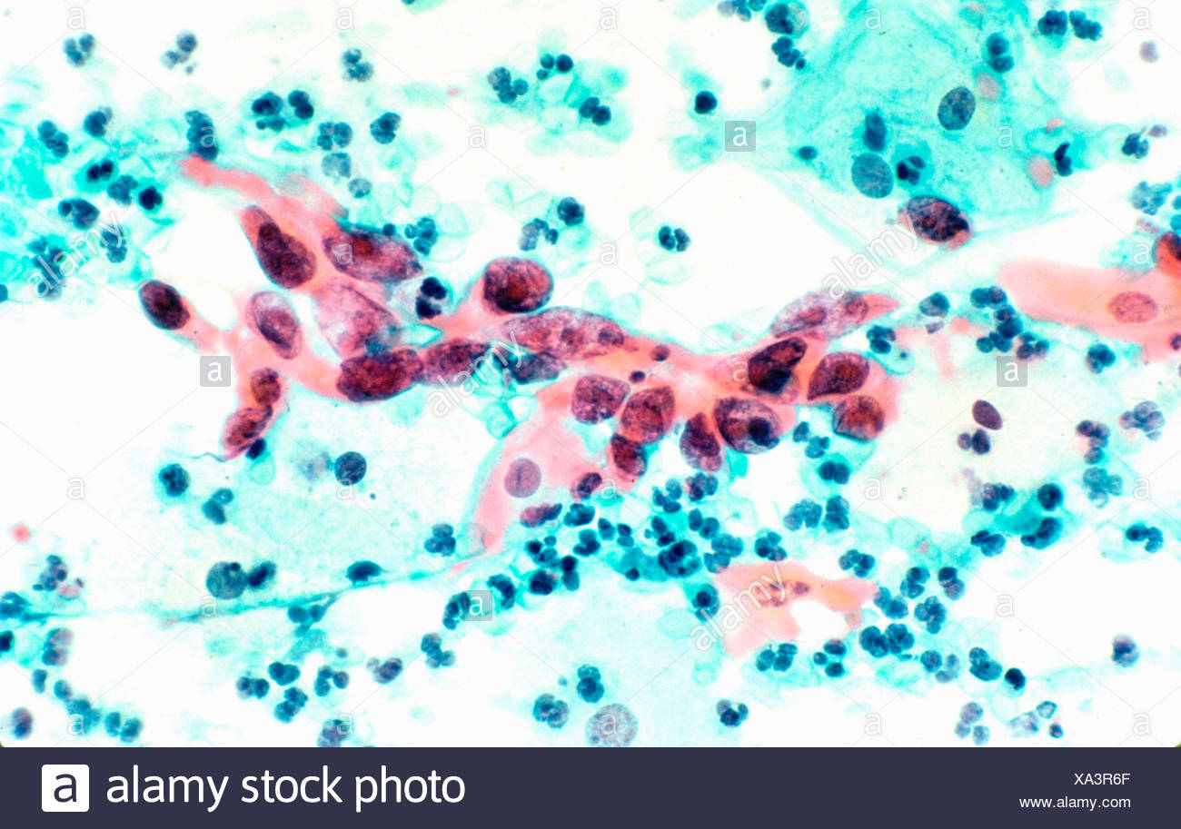 Cervix Stock Photos & Cervix Stock Images - Alamy