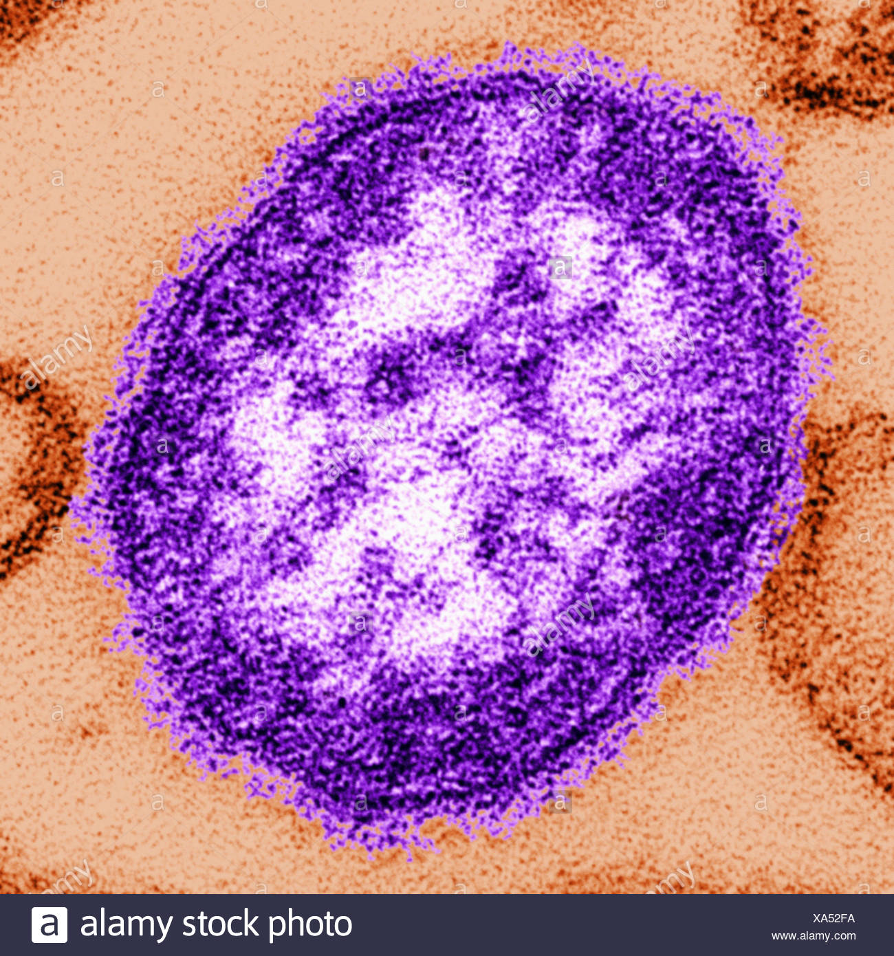 Measles Virus Micrograph High Resolution Stock Photography and Images ...
