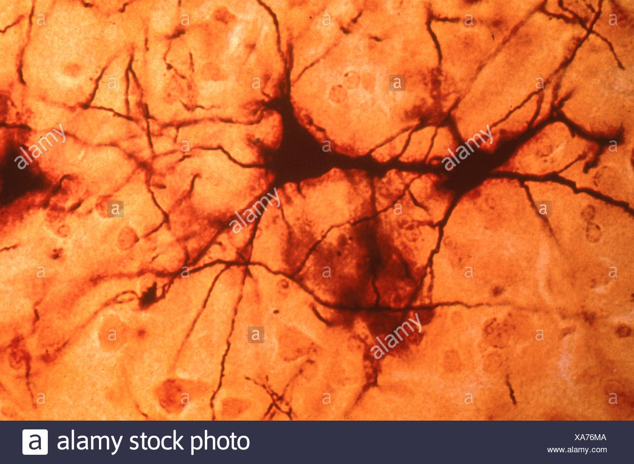 Normal Neuron High Resolution Stock Photography and Images - Alamy