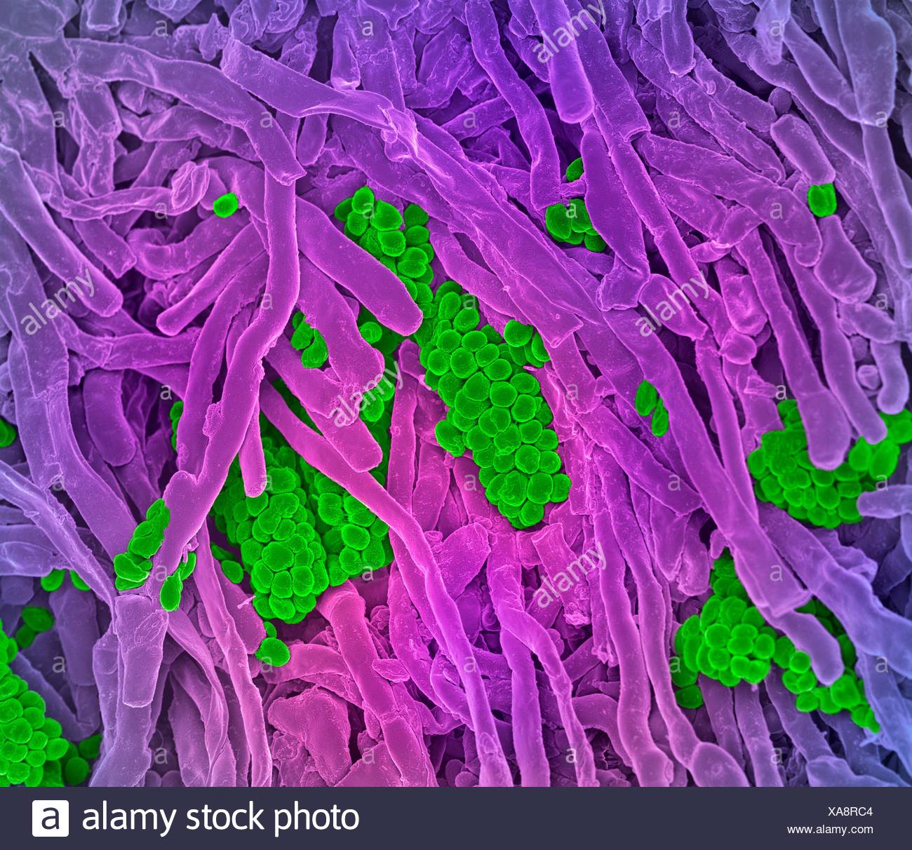 Streptomyces High Resolution Stock Photography and Images - Alamy