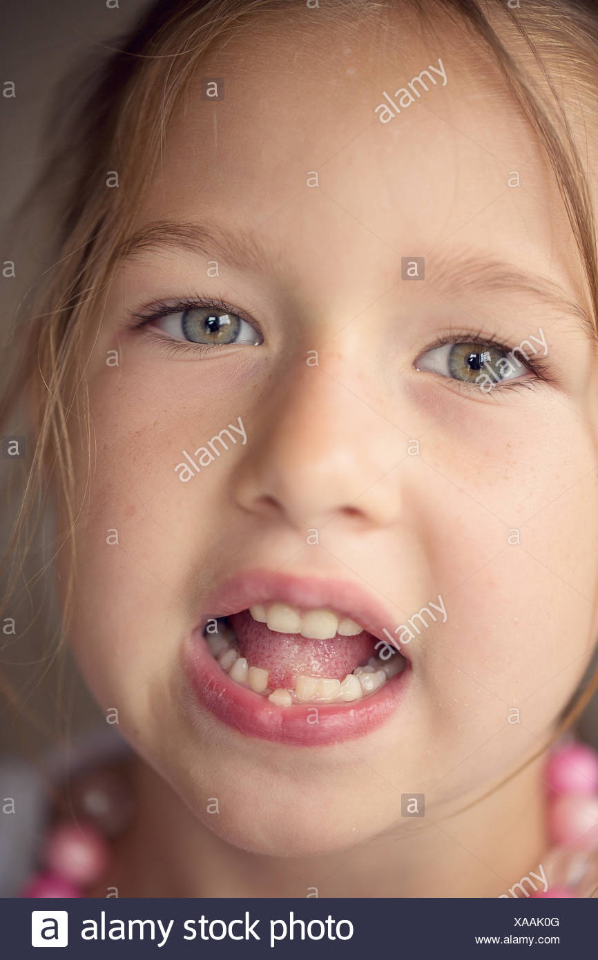 Loose Tooth High Resolution Stock Photography and Images - Alamy