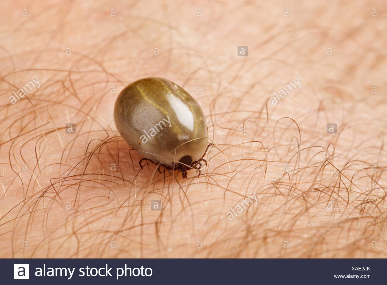 Parasitic Mite Infection Of The Skin Stock Photos & Parasitic Mite ...