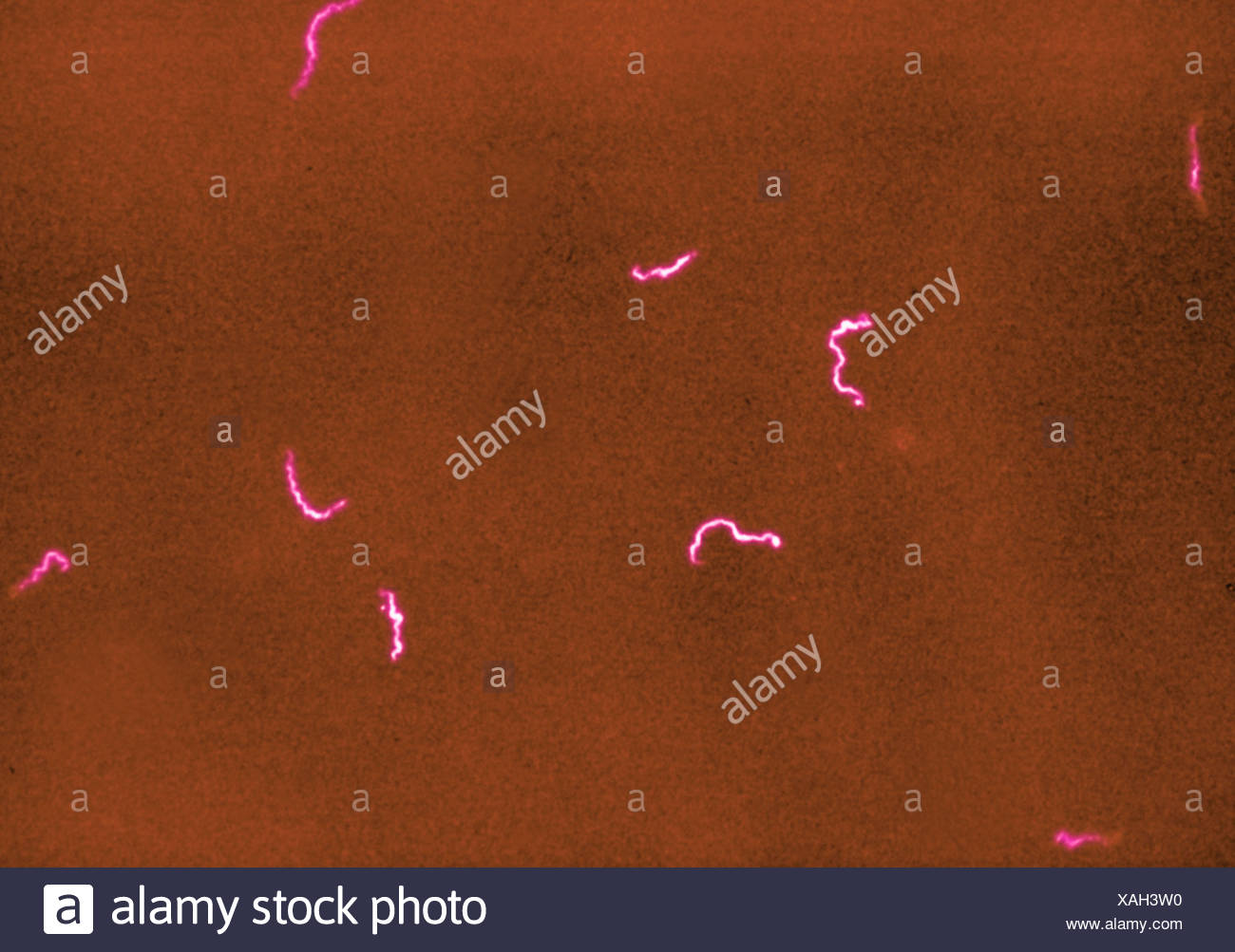 Treponema Pallidum High Resolution Stock Photography and Images - Alamy