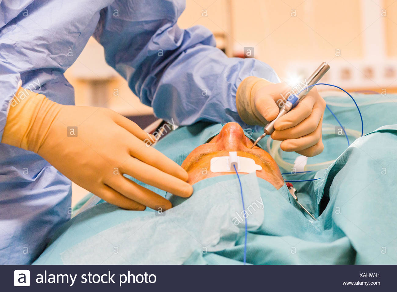 Neuronavigation Stock Photos & Neuronavigation Stock Images - Alamy
