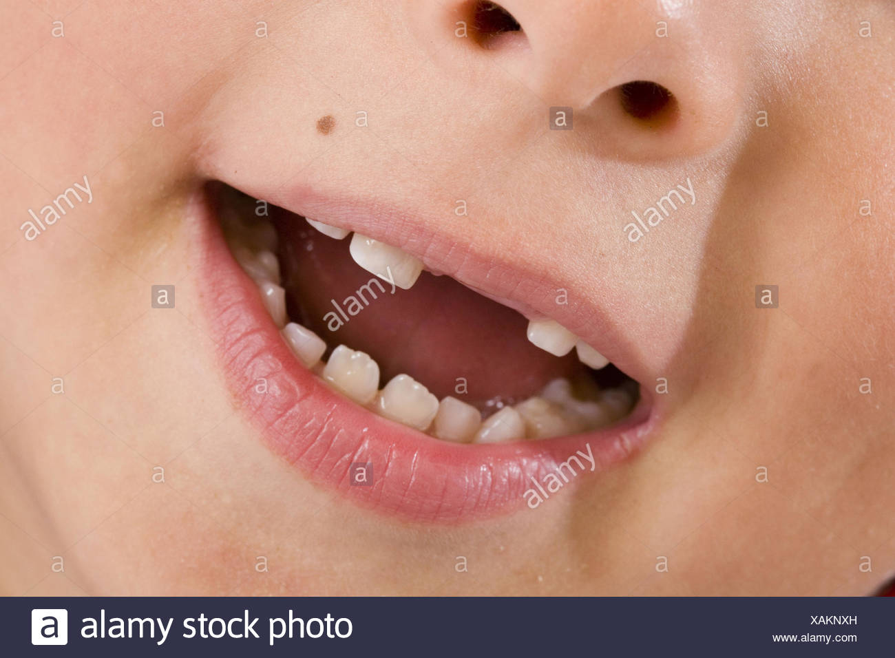 Space Between Teeth High Resolution Stock Photography and Images - Alamy