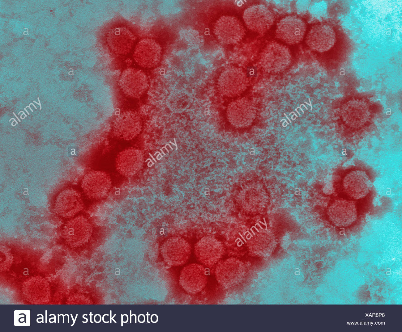 Adenovirus Electron High Resolution Stock Photography and Images - Alamy