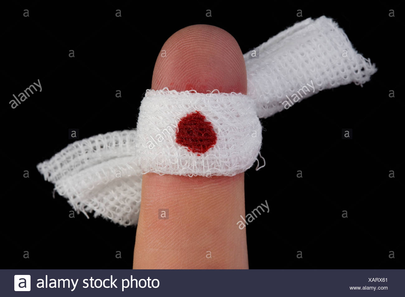 Wound Bleeding Stock Photos & Wound Bleeding Stock Images - Alamy