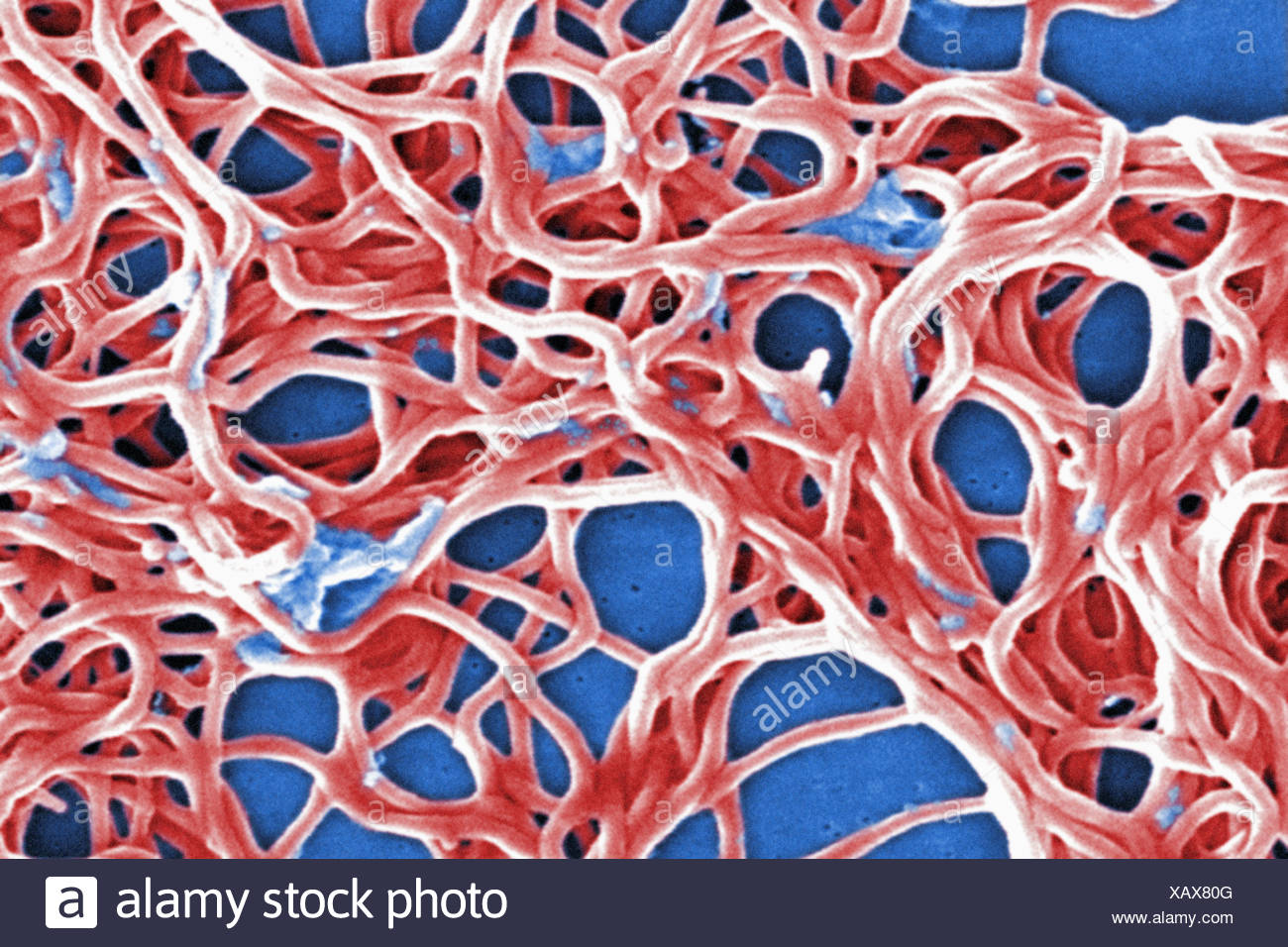 Borrelia Burgdorferi Bacteria High Resolution Stock Photography and ...