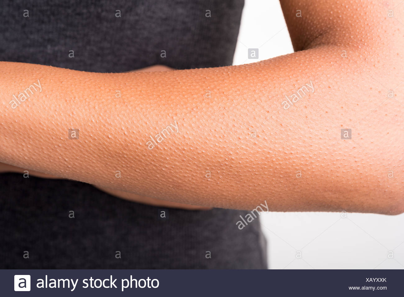 Cold Nipple High Resolution Stock Photography and Images - Alamy
