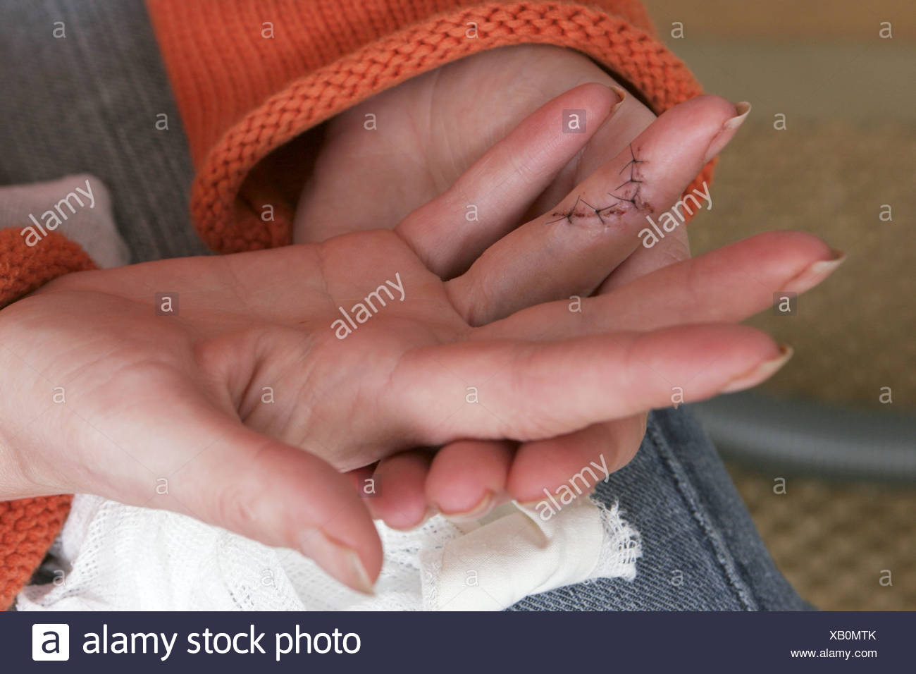 Closed Wound High Resolution Stock Photography and Images - Alamy