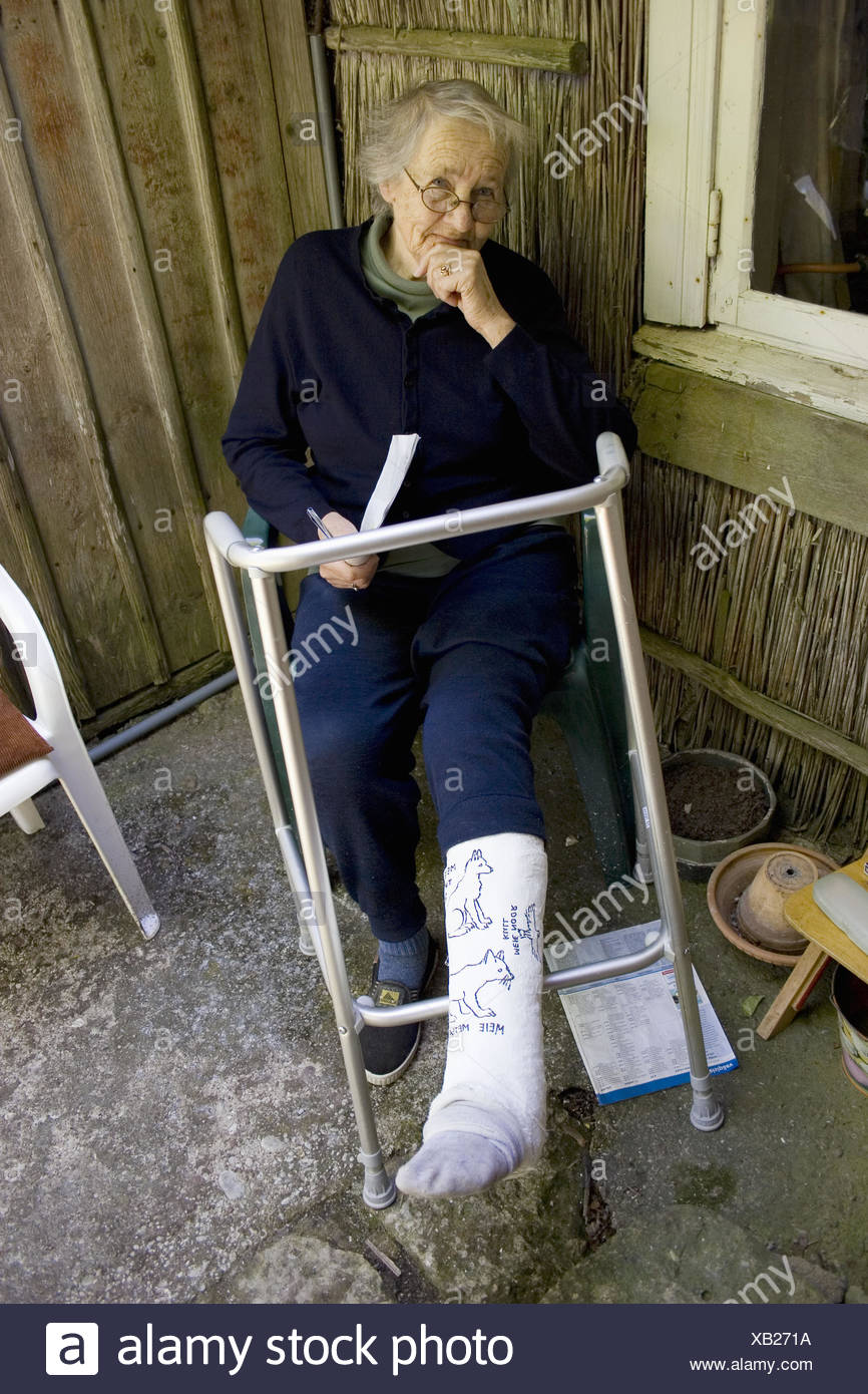 Woman Leg Cast Stock Photos & Woman Leg Cast Stock Images - Alamy