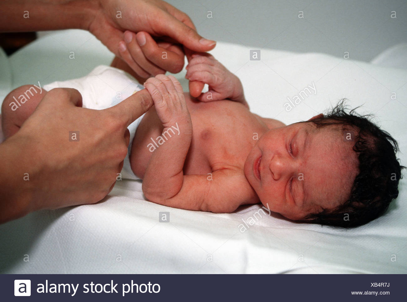 Babinski Reflex High Resolution Stock Photography and Images - Alamy