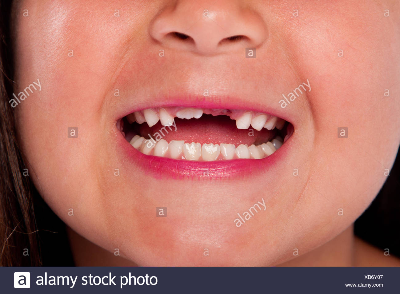 Child Lips Nose Mouth High Resolution Stock Photography and Images - Alamy