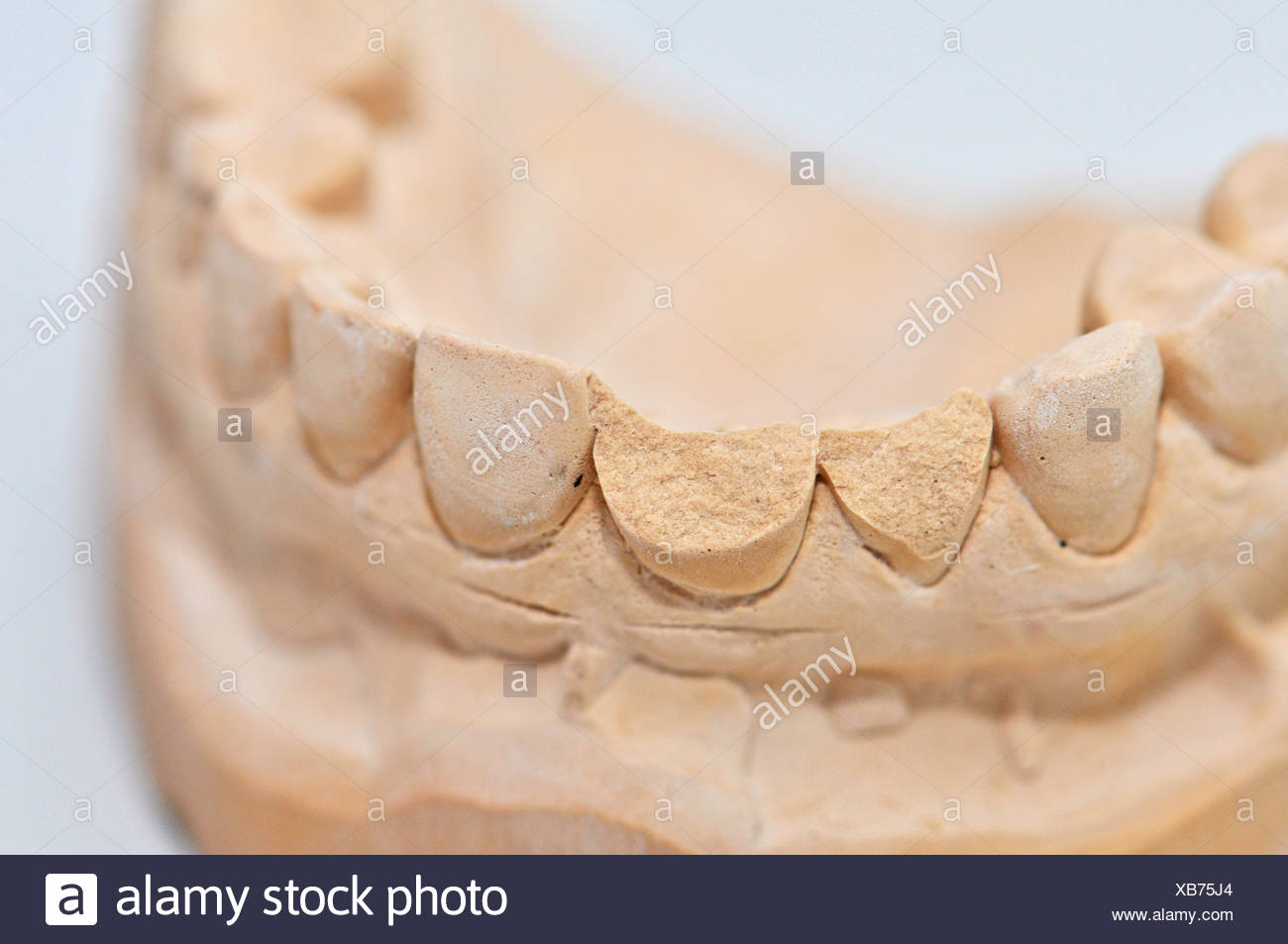 Kieferchirurgie Stock Photos & Kieferchirurgie Stock Images - Alamy