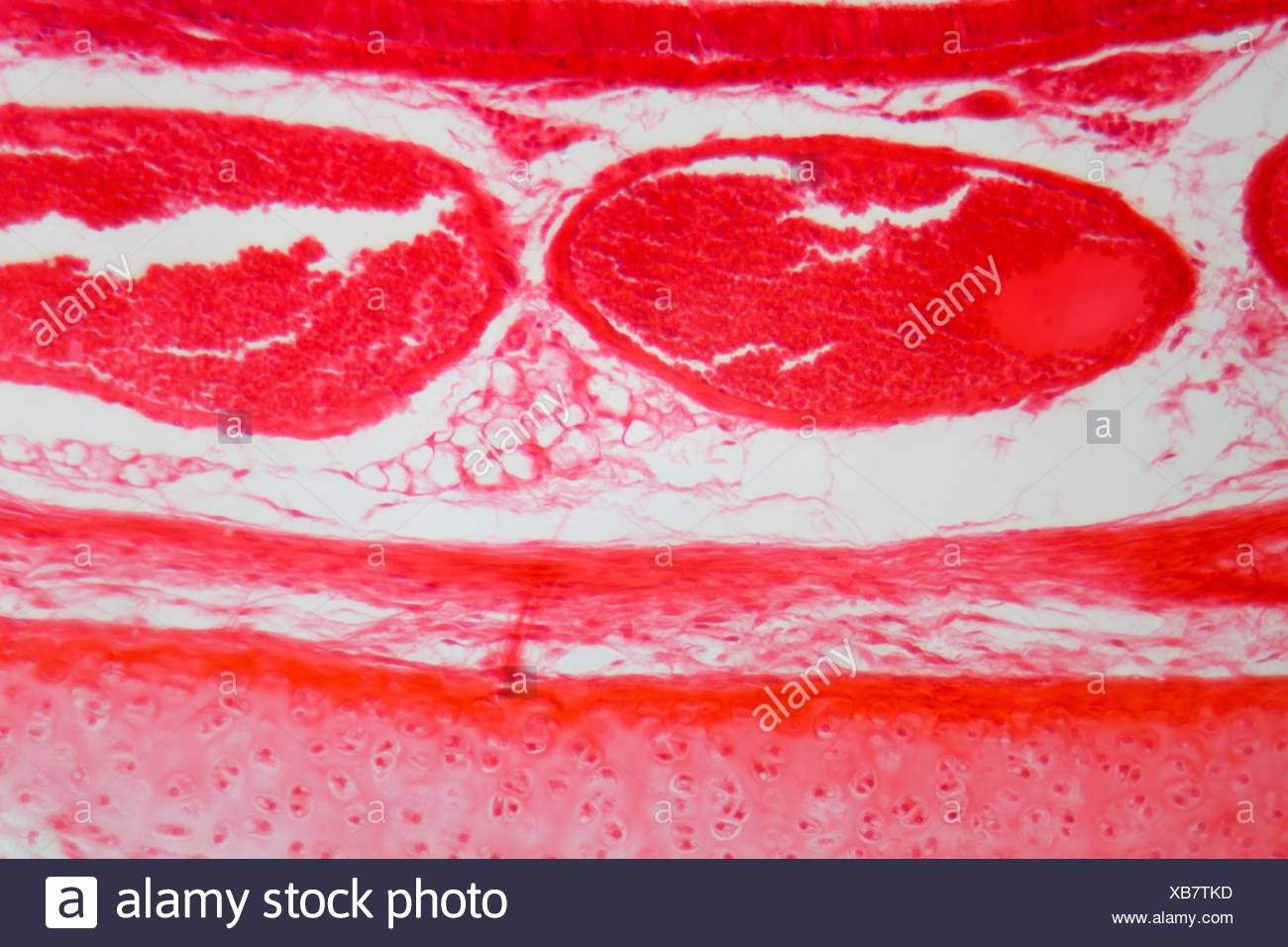 Trachea Micrograph High Resolution Stock Photography and Images - Alamy