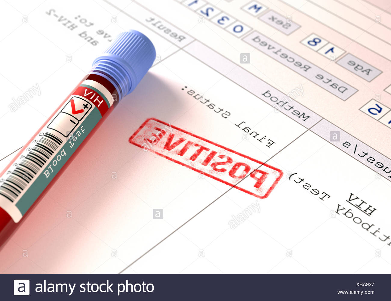 Hiv Negative High Resolution Stock Photography And Images Alamy hiv-negative-high-resolution-stock-photography-and-images-alamy
