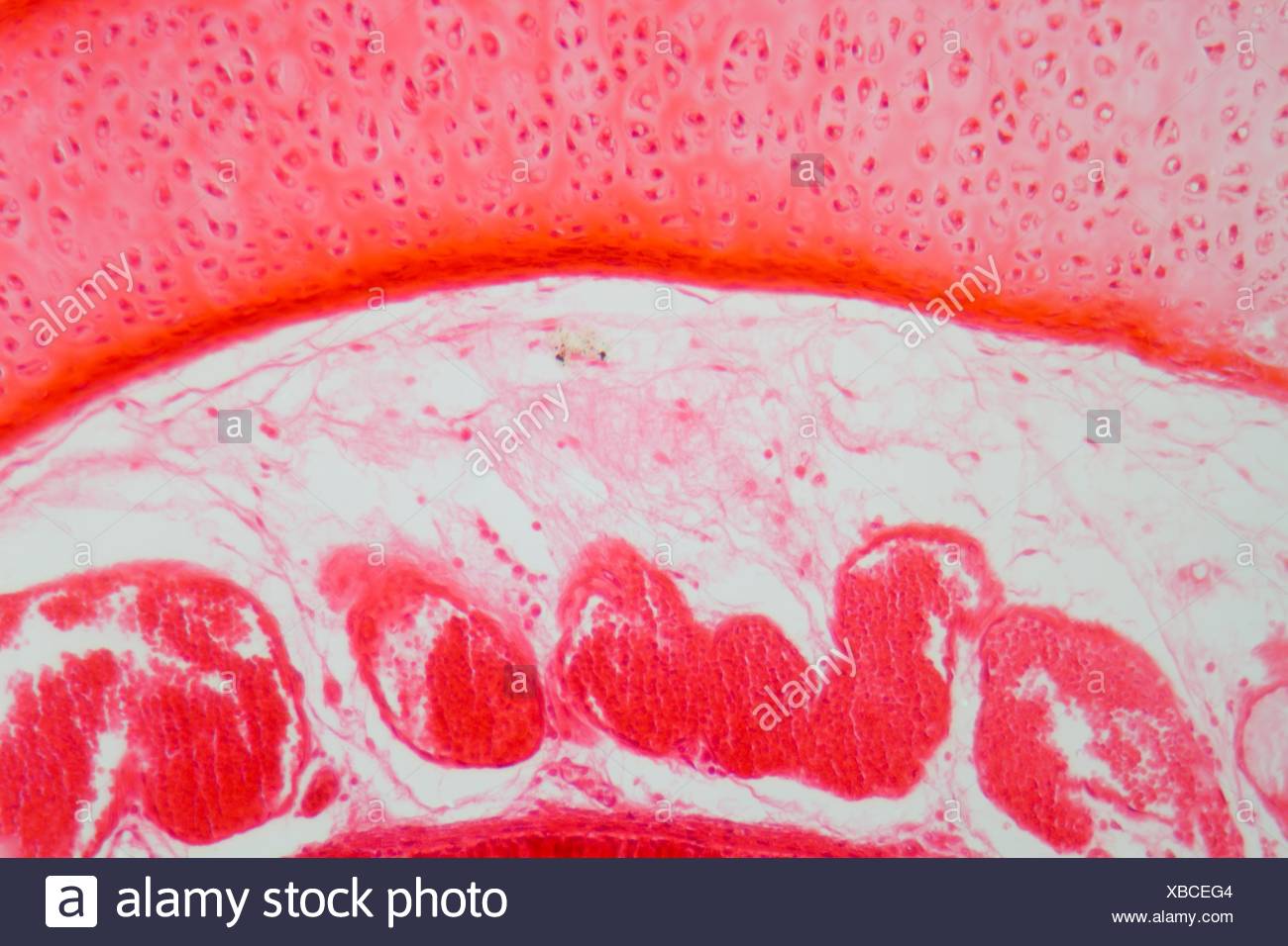 Trachea Stock Photos & Trachea Stock Images - Alamy