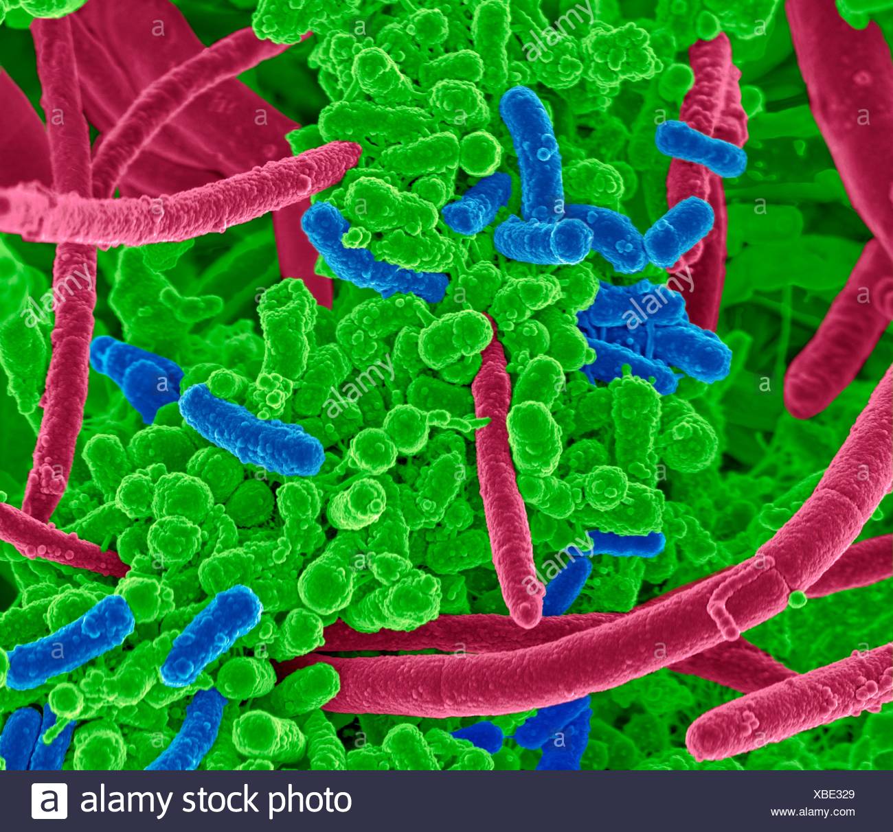 Oral Bacteria Stock Photos & Oral Bacteria Stock Images - Alamy