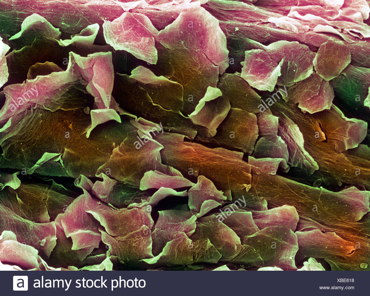 Dead Skin Cells High Resolution Stock Photography and Images - Alamy